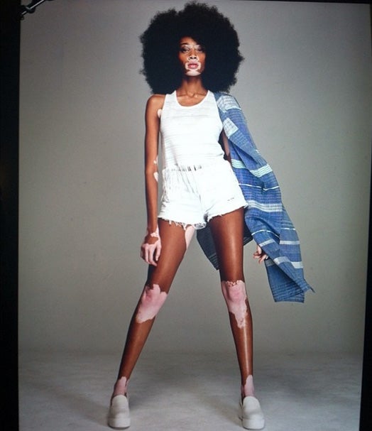 Winnie Harlow, la primera modelo con vitíligo | Diario Sur