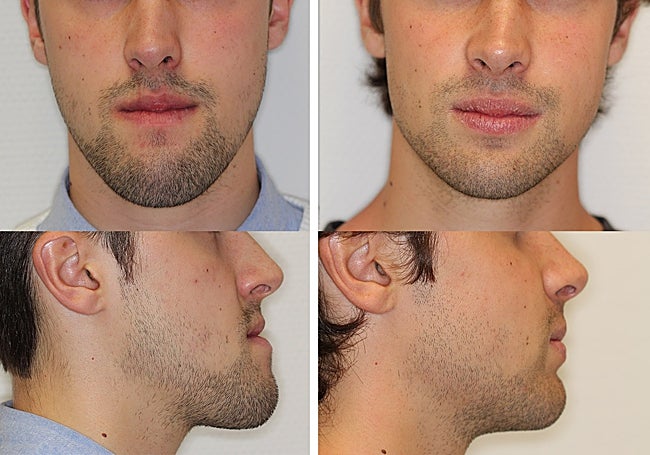 Deformidades dentofaciales: qué son y cómo se corrigen | El Diario Vasco