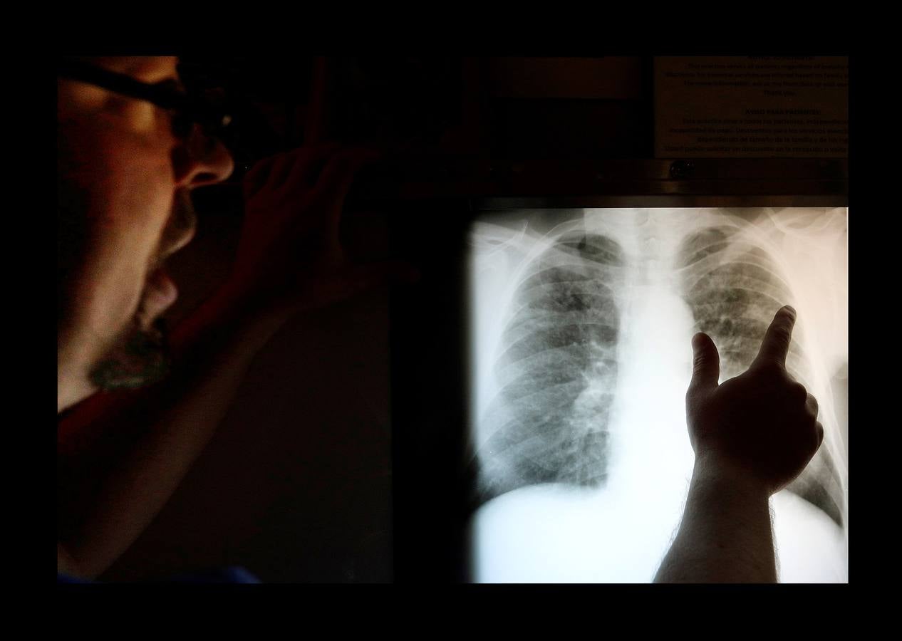 Fotos: Pulmón negro | El Correo