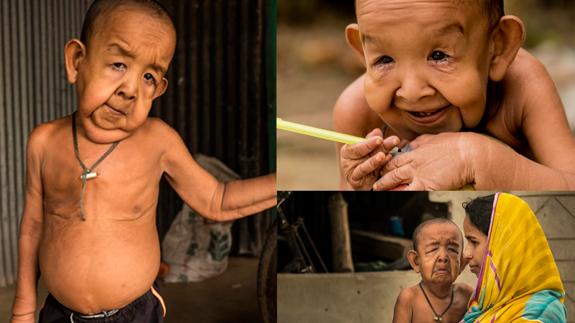 El Benjamin Button real: tiene 4 años pero aparenta 80 | Ideal