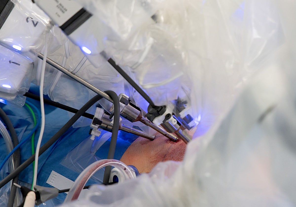 Condenan a una clínica de cirugía estética por causar una perforación ...